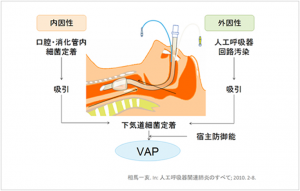 VAP（人工呼吸関連肺炎）の看護｜原因や予防バンドル、ガイドライン、6つの看護ポイント | ナースのヒント
